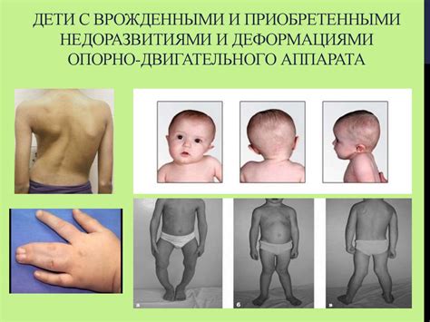 Клинико психолого педагогическая характеристика детей с нарушением