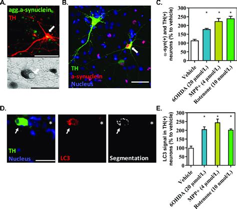 Alpha Synucleinopathy In Dopaminergic Neurons After Exposure To 6ohda