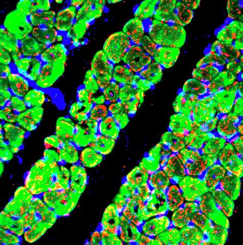 Heart Muscle Photograph By R Bick B Poindexter Ut Medical School