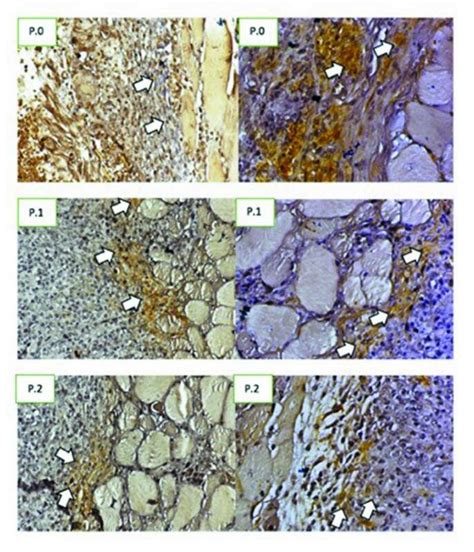 Immunohistochemistry Staining Of Bcl 2 Expression Left P0 P1 Dan