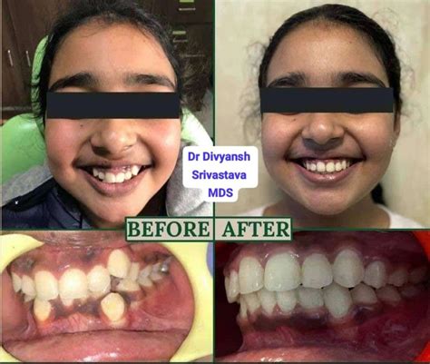 Dr Divyansh Srivastava On Linkedin Fix Ortho Case