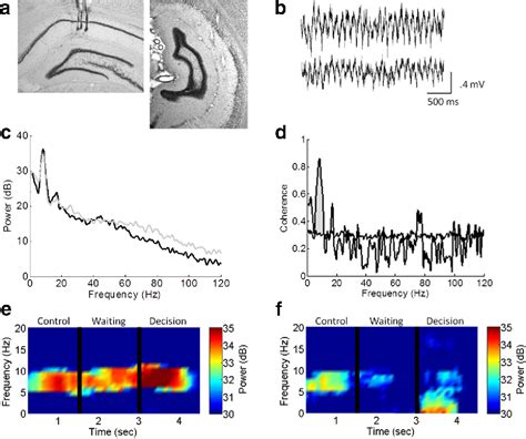 Figure 3 From Dissociation Between Dorsal And Ventral Hippocampal Theta