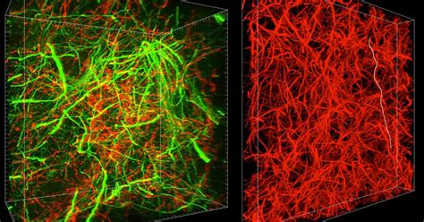 Multi Scale Imaging Technique Brings The Brain Into Focus