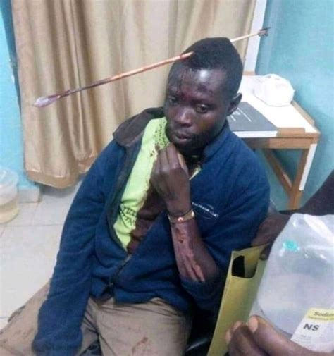 Dudes Got His Head Shot Through With Arrow GoreCenter