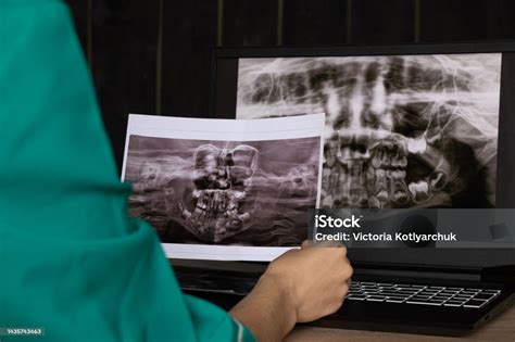 두 턱의 어린이 치아의 파노라마 X 선 의사 테이블의 노트북 화면에 어린이 치아의 Orthopantomogram 이빨에 대한