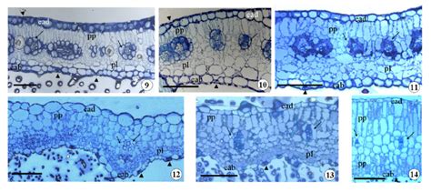 Figures 9 14 Micrographies Of The Middle Leaf Transversal Sections Of