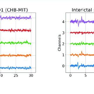 For Case 01 Of The CHB MIT Scalp EEG Dataset We Plot A Few Channels Of Download Scientific