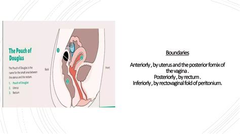 Rectouterine Pouch Pptx