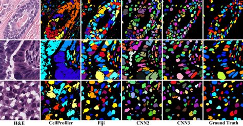 Hande Stained Images With Comparison Of Segmentation Results Using