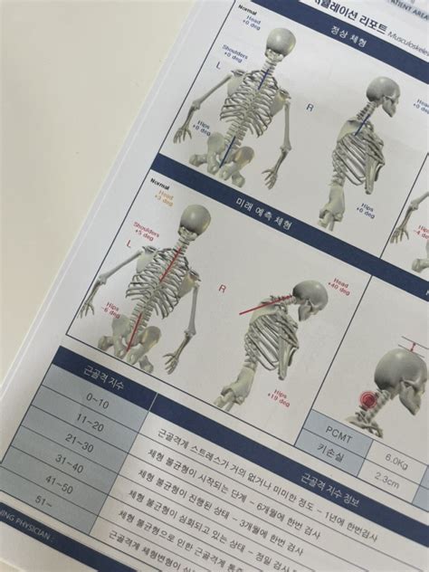 창원 체형교정 창원 재활pt 전문 다나아짐운동재활센터 네이버 블로그