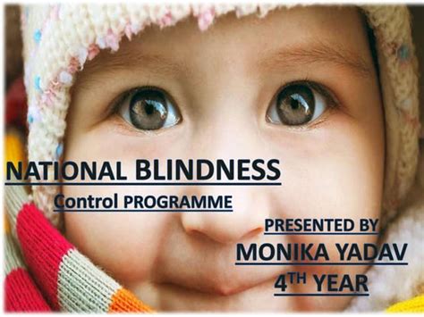National Blind Control Programme Or Blind Programme Pptx