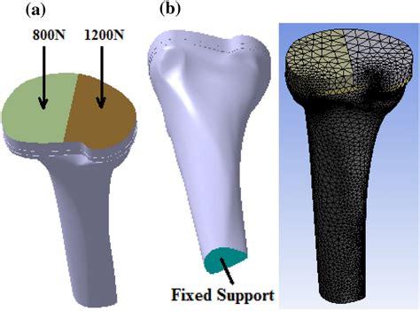 A Loading Conditions Applied To Artificial Model B Finite Element Of Download Scientific