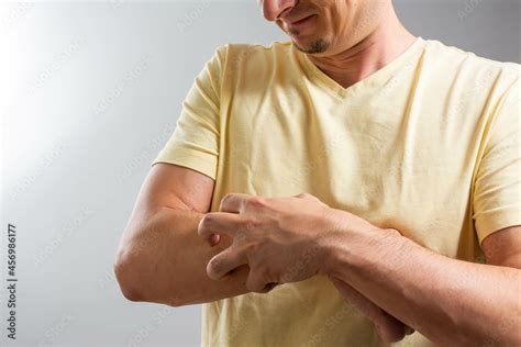 Annoyed Middle Aged Man In Yellow T Shirt Scratching Itch On His Arm