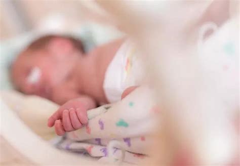 Stroke In Pediatric Patients During Ecmo Findings From A National