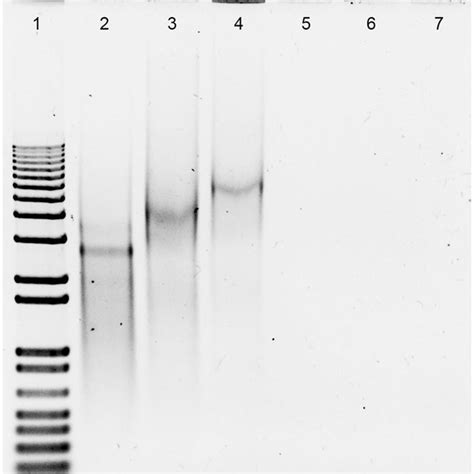 Ssb Protein Binding Assay In Vitro Electrophoresis After Ssb Protein