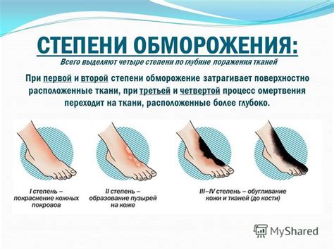 Первая помощь при обморожении рук, ног, пальцев, лица у ребёнка ...