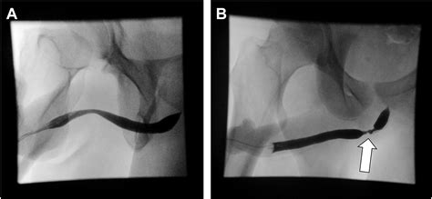 Morphologic Urologic Imaging Urologic Clinics