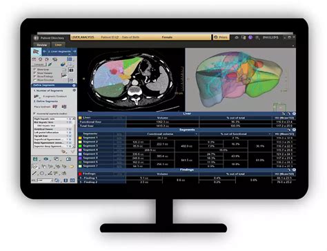 Philips Ct Liver Analysis Advanced Liver Segmentation