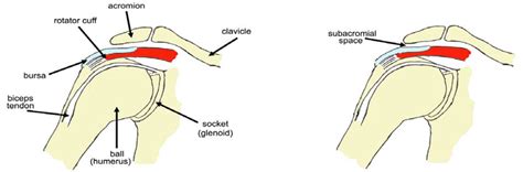 Subacromial Space Shoulder Anatomy Orthopaedic Surgery Specialist Dr Amyn Rajani