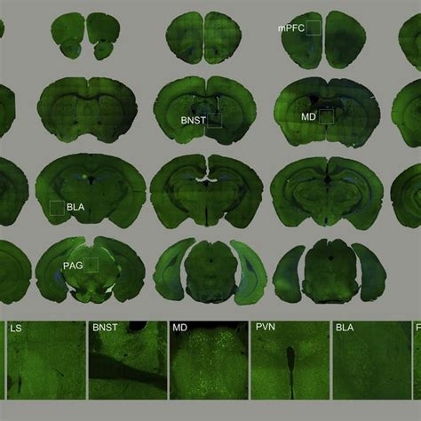 Overall C Fos Activation Patterns In The Control Mouse Brain A
