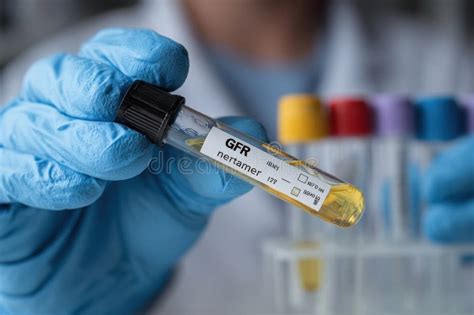 Lab Technician Presents Gfr Test Results In A Minimal Layout Showing A Vial With Clear Labels In