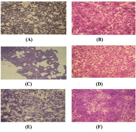 Purification Characterization And Anticancer Activity Of L Asparaginase Produced By Marine