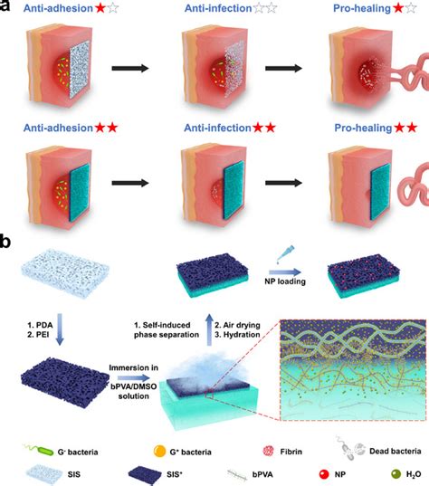 Polymer Brush‐based Asymmetric Porous Patch With Excellent Anti‐bacterial And Anti‐contamination