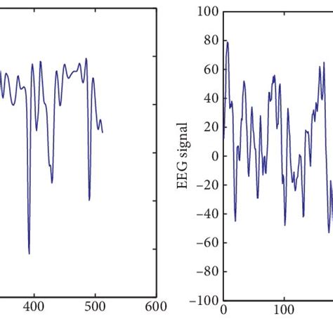 Examples Of Eeg Signals A For An Epileptic Person And B For A Healthy
