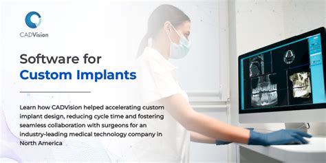 software for custom implants cadvision engineers