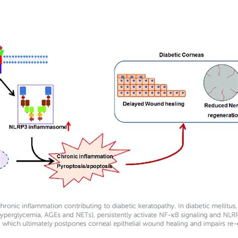 SP NK 1R Signaling Regulates Diabetic Corneal Epithelial Wound Healing