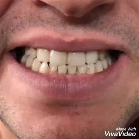 ‎دکتر مهدی فرهادی‎ Drmehdifarhadi • Instagram Photos And Videos