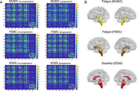 Matrices A And Network Hubs B From Structural Covariance Network