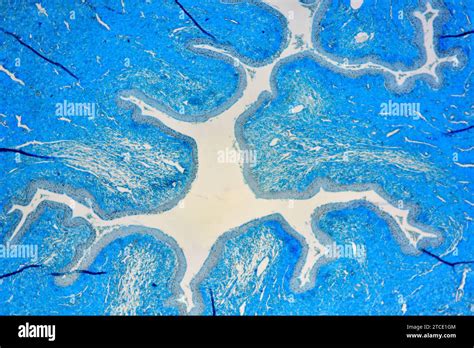 Human Urethra Showing Epithelium Lamina Propria And Smooth Muscle
