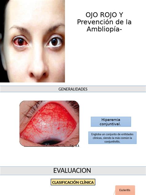 Ojo Rojo Pdf Medicina Visión