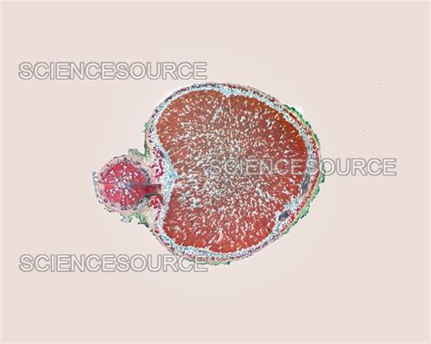 Soybean Root Nodule Cross Section Stock Image Science Source Images