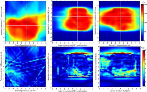 3d Dose Reconstruction Of A Seven Field Clinical Step And Shoot Imrt Download Scientific
