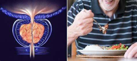 Cinco Alimentos Que Debe Consumir Para Cuidar La Próstata Inclúyalos