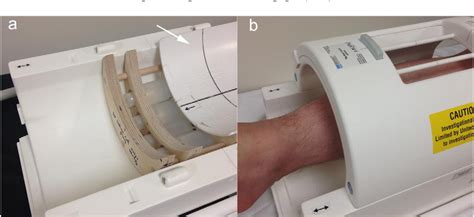 Figure 1 From Sex Differences In Sodium Deposition In Human Muscle And Skin Semantic Scholar