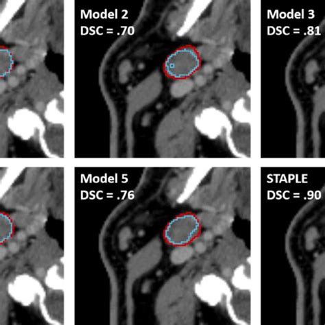 Five Sub Model Testing Segmentation Masks And One Consensus Download Scientific Diagram