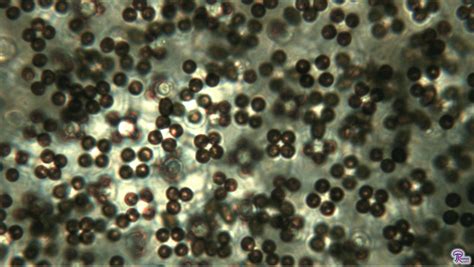 013 characteristics of division basidiomycota fungus fact friday