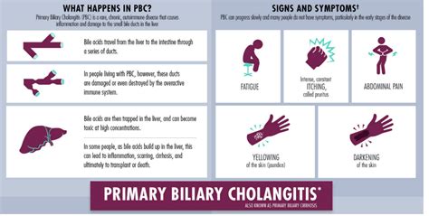 What Are The Signs Of The Deadly Disease Primary Biliary Cholangitis Liver Bile Liver Disease