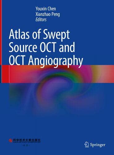 Atlas Of Swept Source Oct And Oct Angiography Cheap Ebooks