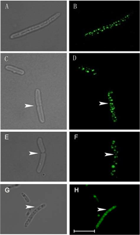 Intracellular Localization Patterns Of Crmine Egfp In E Coli Cells