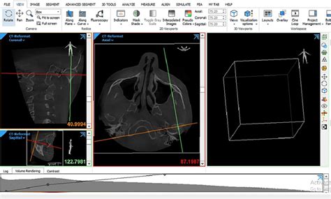 Cone Beam Computed Tomography Cbct Images Reorientation Before