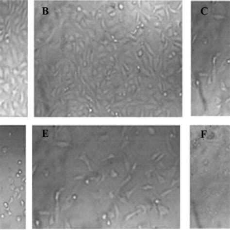 Representative Images 40x Of Panc1 Cells Treated By Different