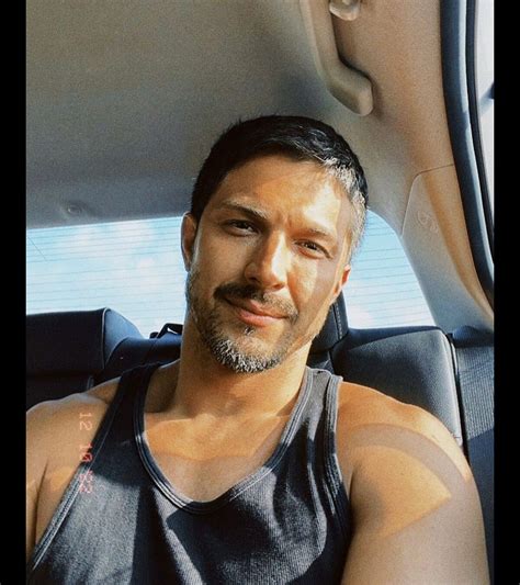 Foto Romulo Estrela Precisou Fazer Duas Cirurgias Para Tratar Do Problema No Coração Purepeople