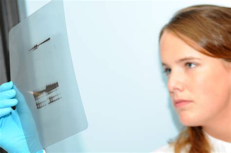 Identification Of Protein Using Western Blot Reagents