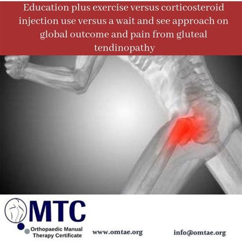 Education Plus Exercise Versus Corticosteroid Injection Use Versus A