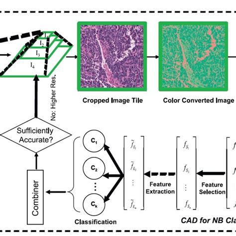 1 Shimada Classification Of Neuroblastic Tumor Download Scientific Diagram