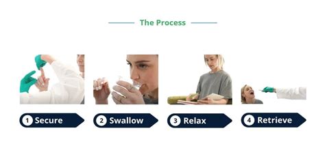 Esophageal String Test — Boston Specialists